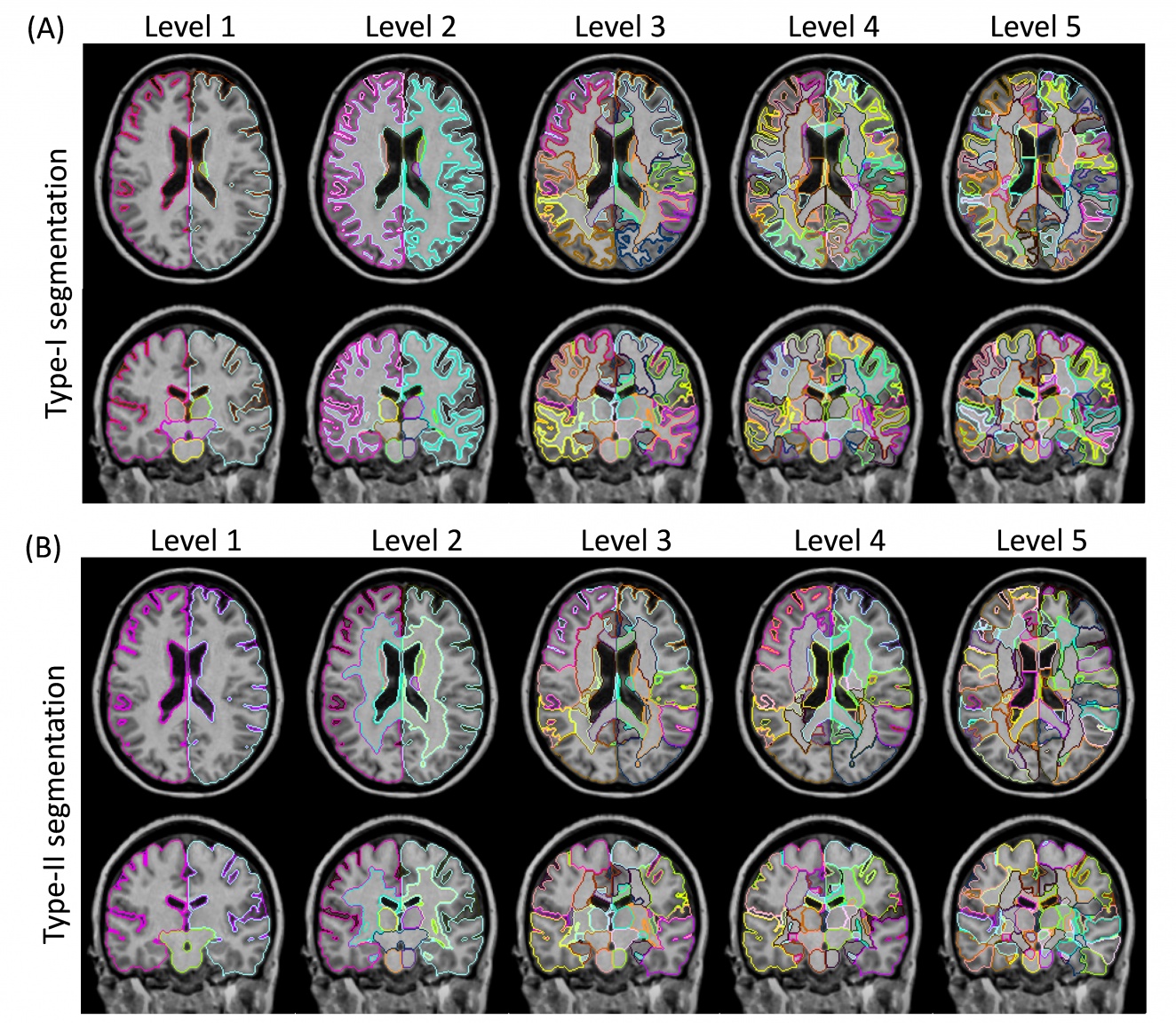 MRICloud: An online cloud-computing platform examines changes in brain ...